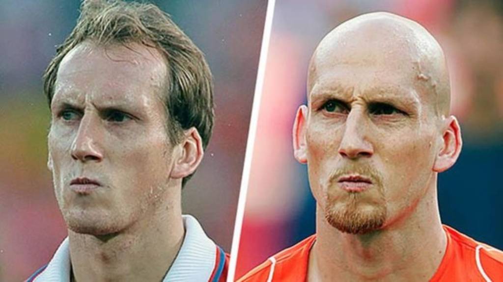 Los 10 jugadores calvos que son irreconocibles con pelo