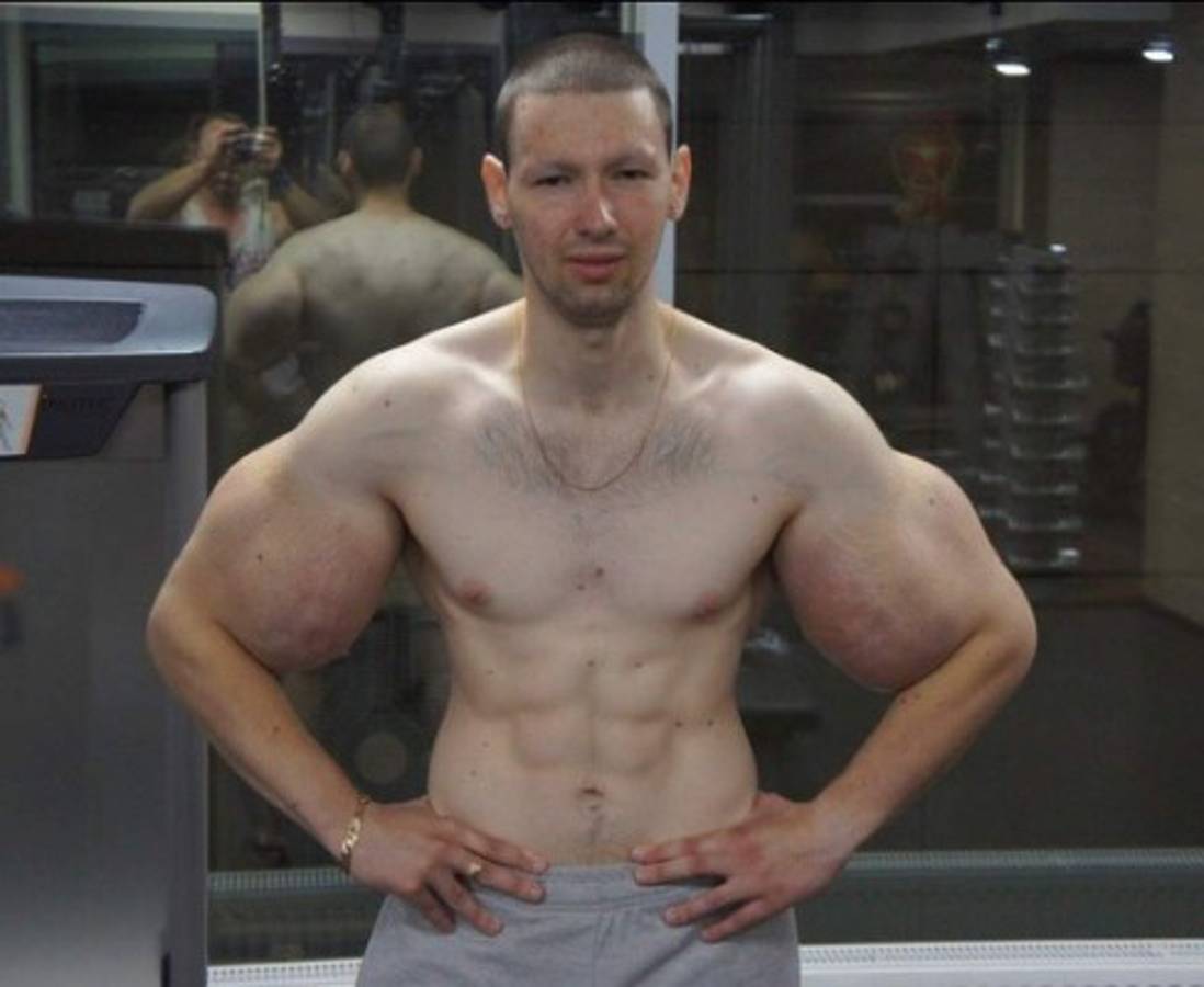 La fea lesión del Popeye ruso: le 'explotan' un brazo en plena pelea y ...