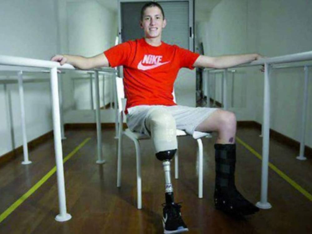 Jackson Follmann ya dio sus primeros pasos con su nueva prótesis