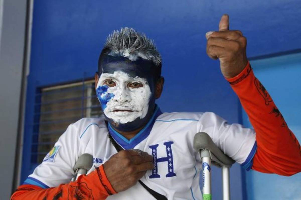 Olman, un ejemplo de garra y amor por Honduras