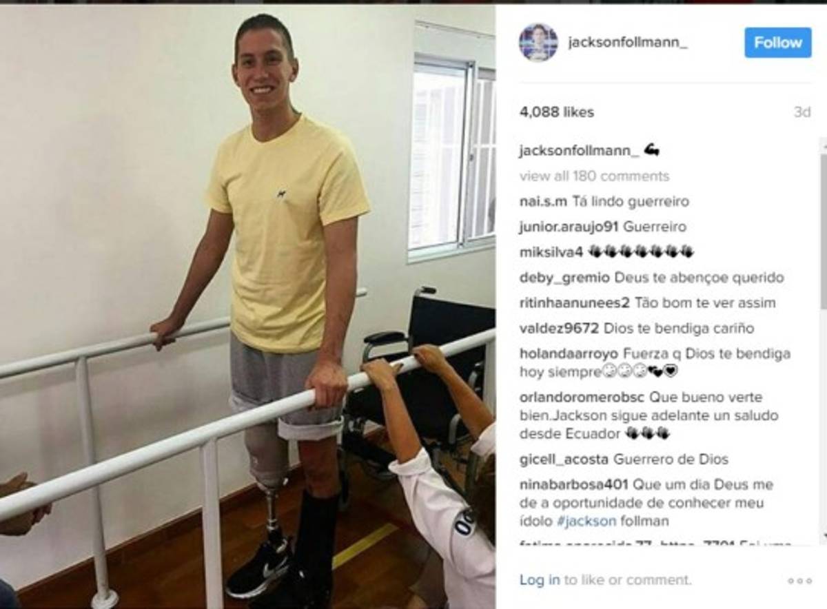 Jackson Follmann ya dio sus primeros pasos con su nueva prótesis