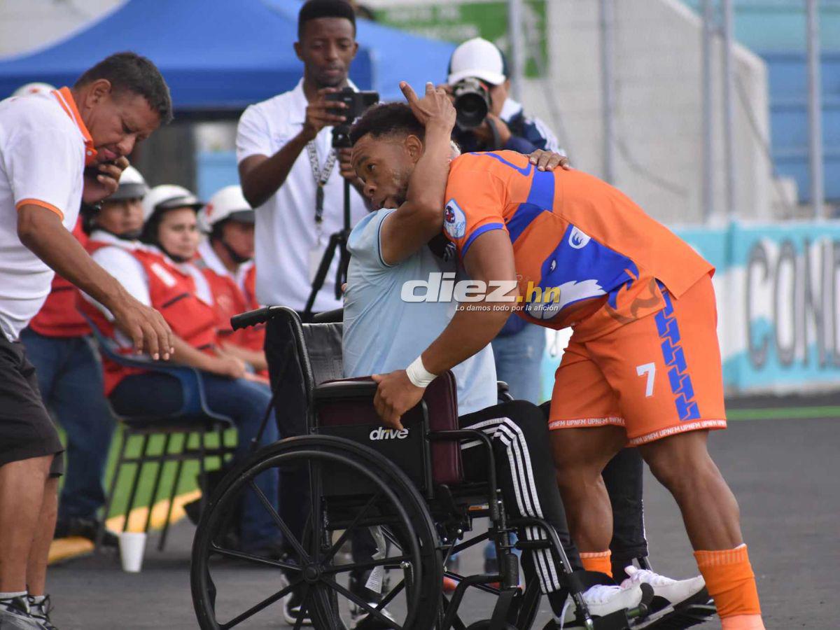Héctor Castellón, DT de UPN, se compara con Washington Tabárez, habla ...